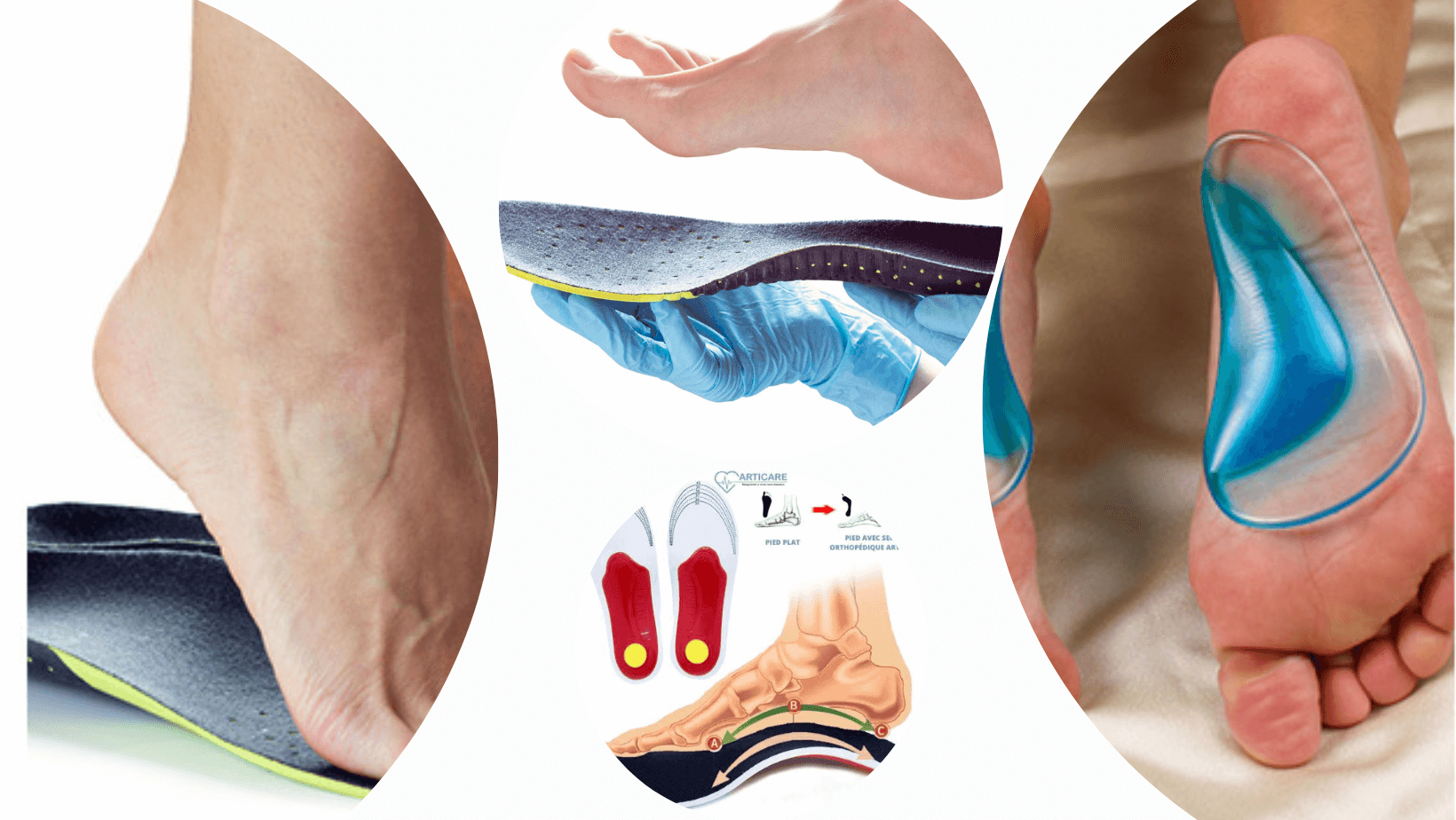 Semelles orthopédique - Medico International Service
